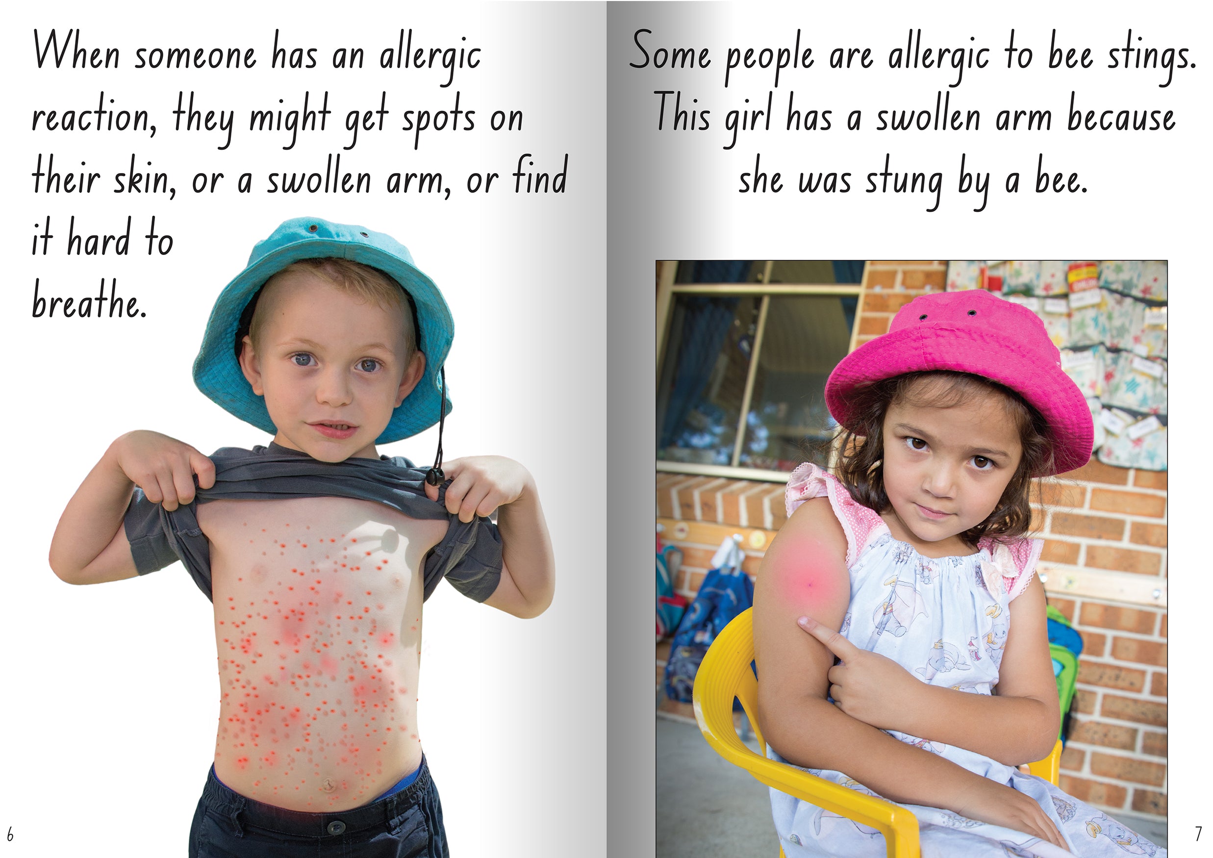Let's Learn about Allergies Big Book — Oz Publishing